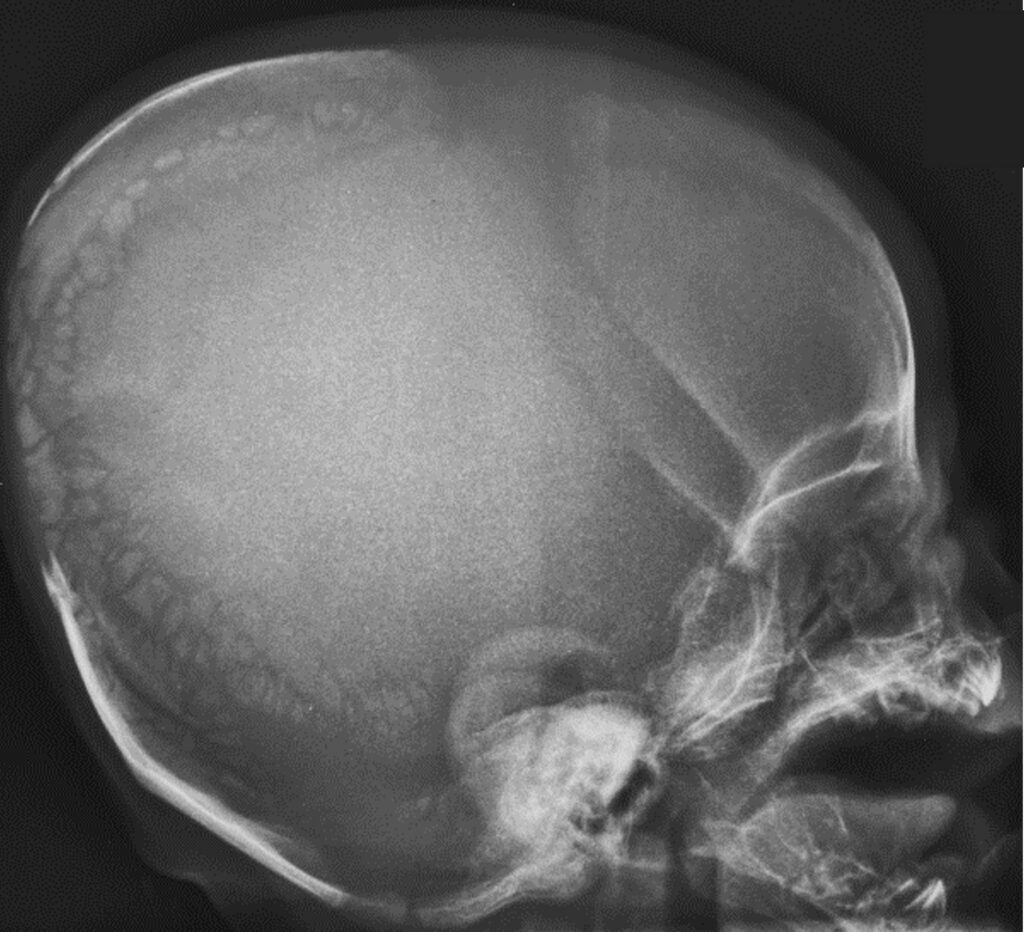 Case 352 – Onestop Radiology